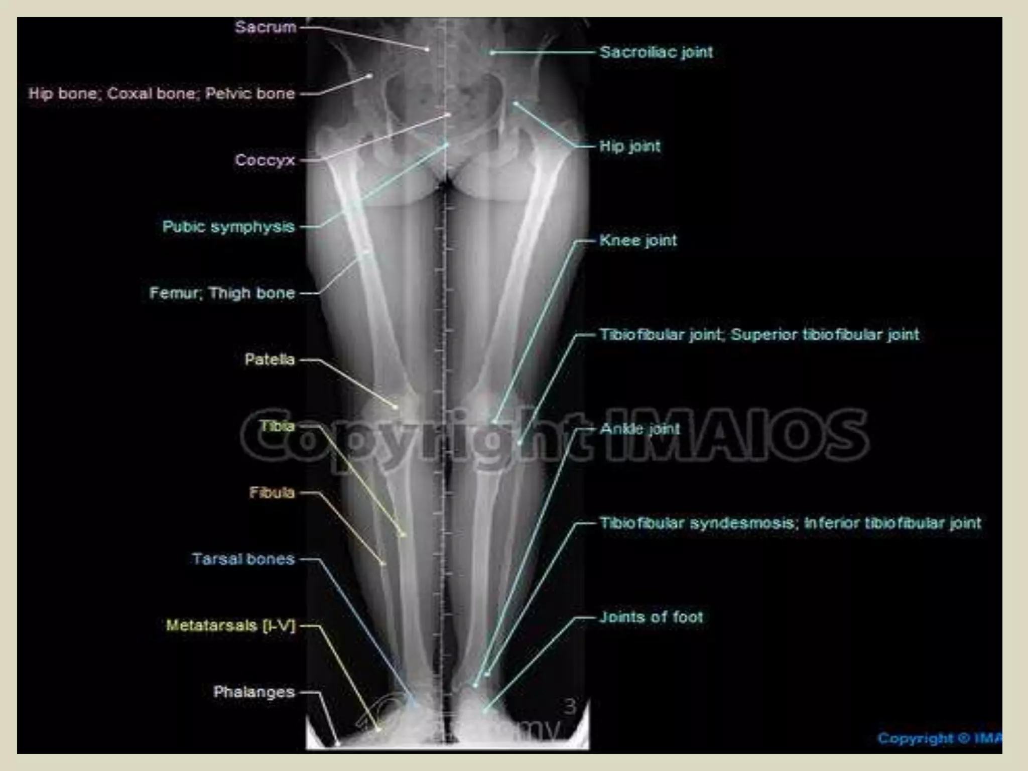 Presentation1.pptx, radiological anatomy of the thigh and leg. | PPTX