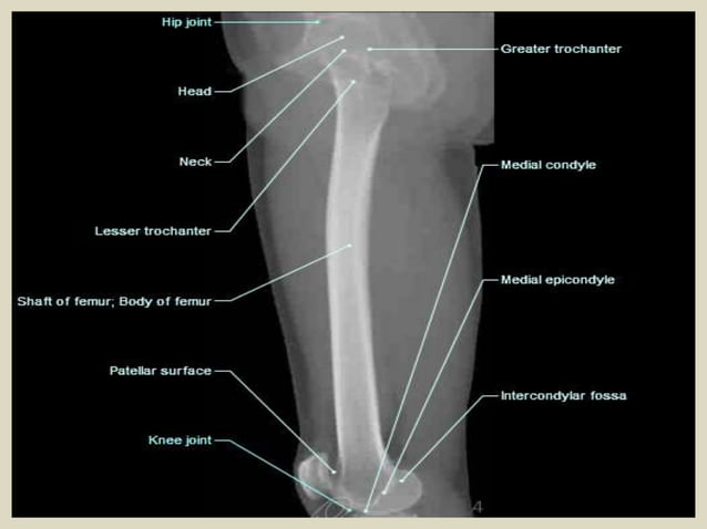 Presentation1.pptx, radiological anatomy of the thigh and leg. | PPTX ...