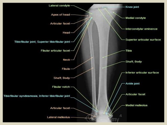 Presentation1.pptx, radiological anatomy of the thigh and leg. | PPTX ...