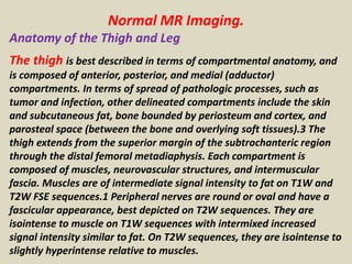 Presentation1.pptx, radiological anatomy of the thigh and leg. | PPTX