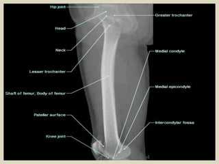 Femur Anatomy Xray