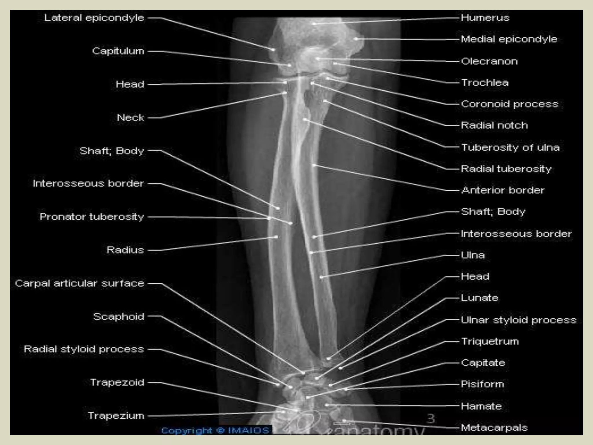 Presentation1.pptx, radiological anatomy of the arm and forearm. | PPTX