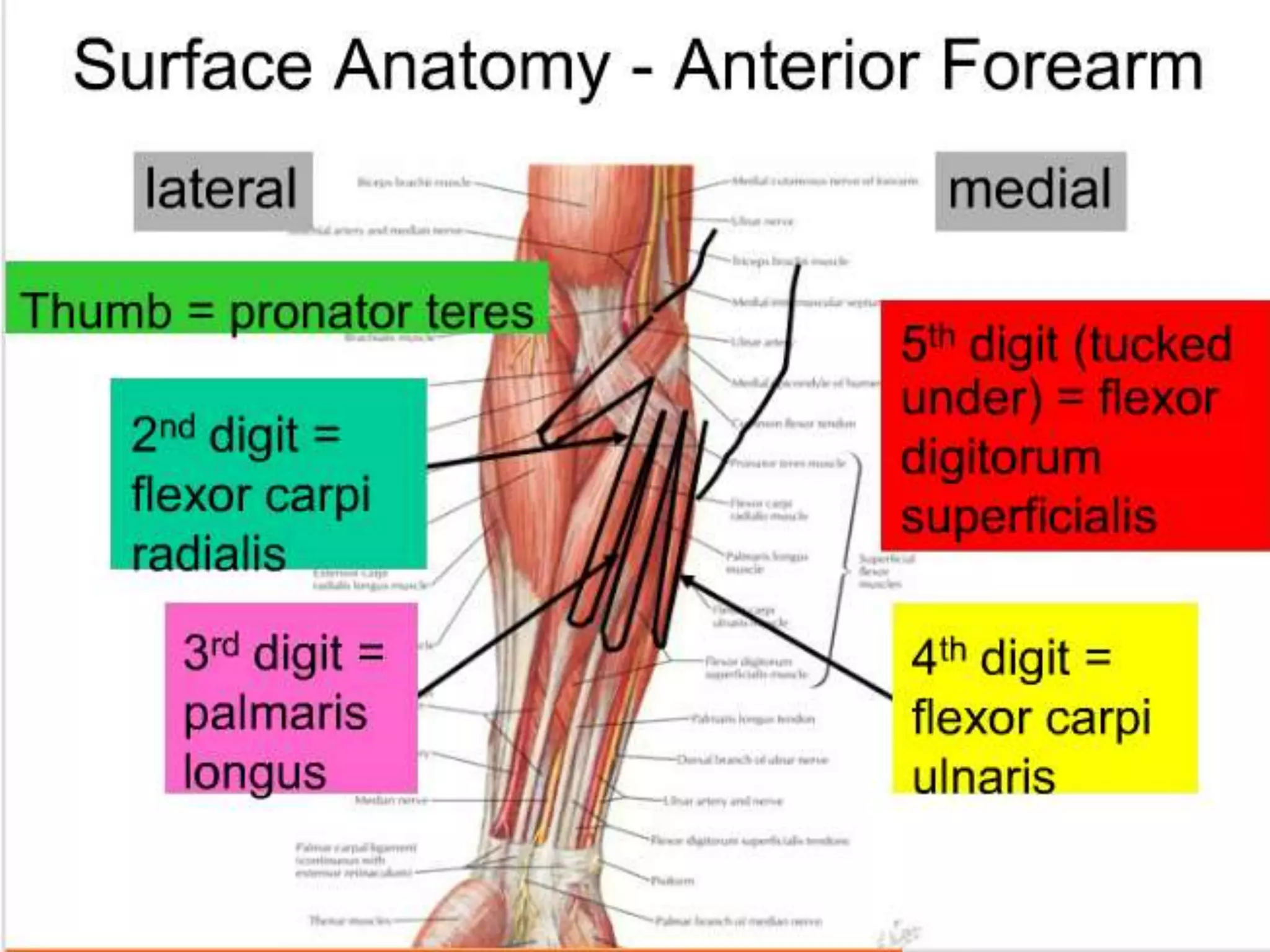 Presentation1.pptx, radiological anatomy of the arm and forearm. | PPTX