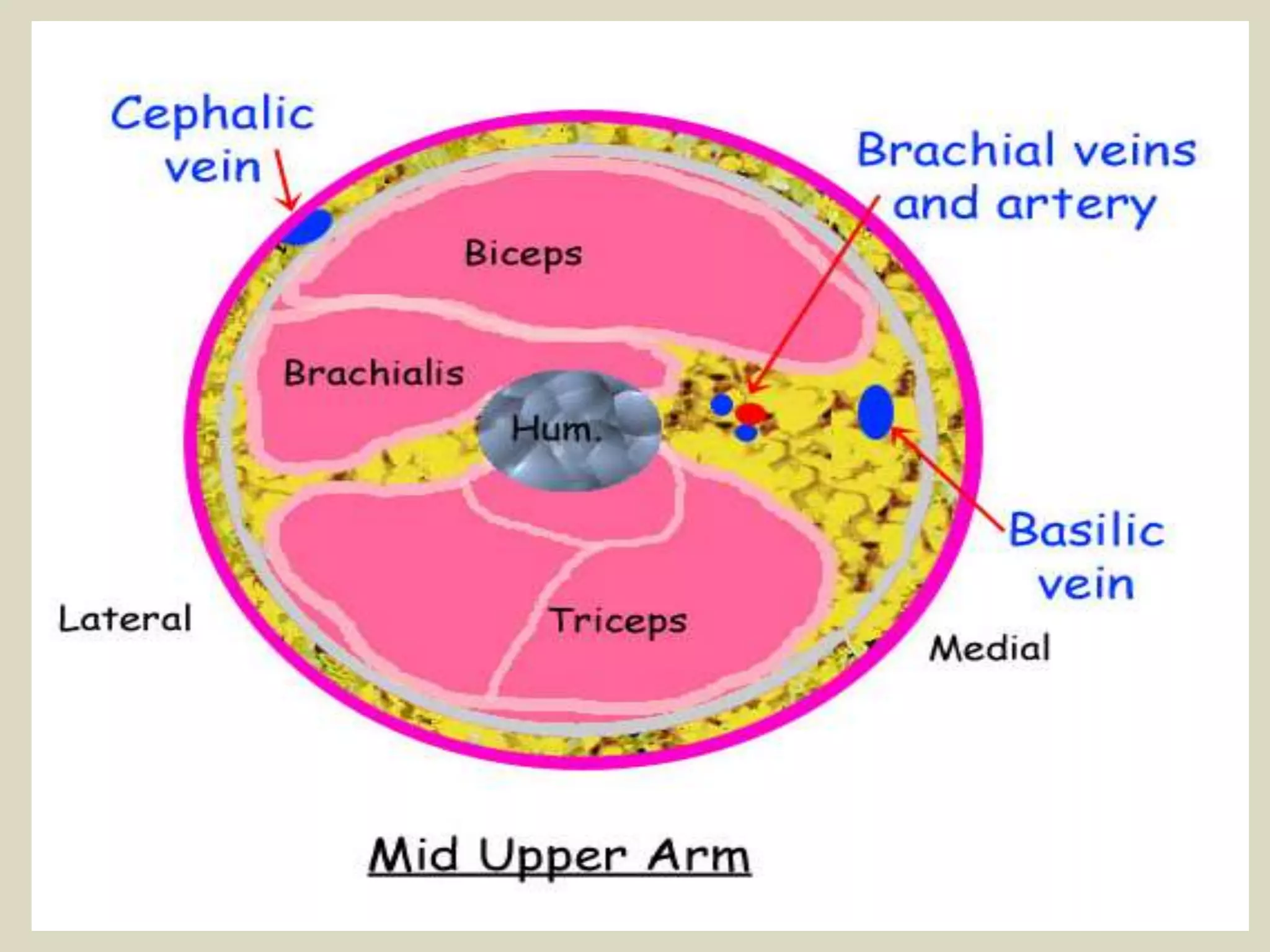 Presentation1.pptx, radiological anatomy of the arm and forearm. | PPTX