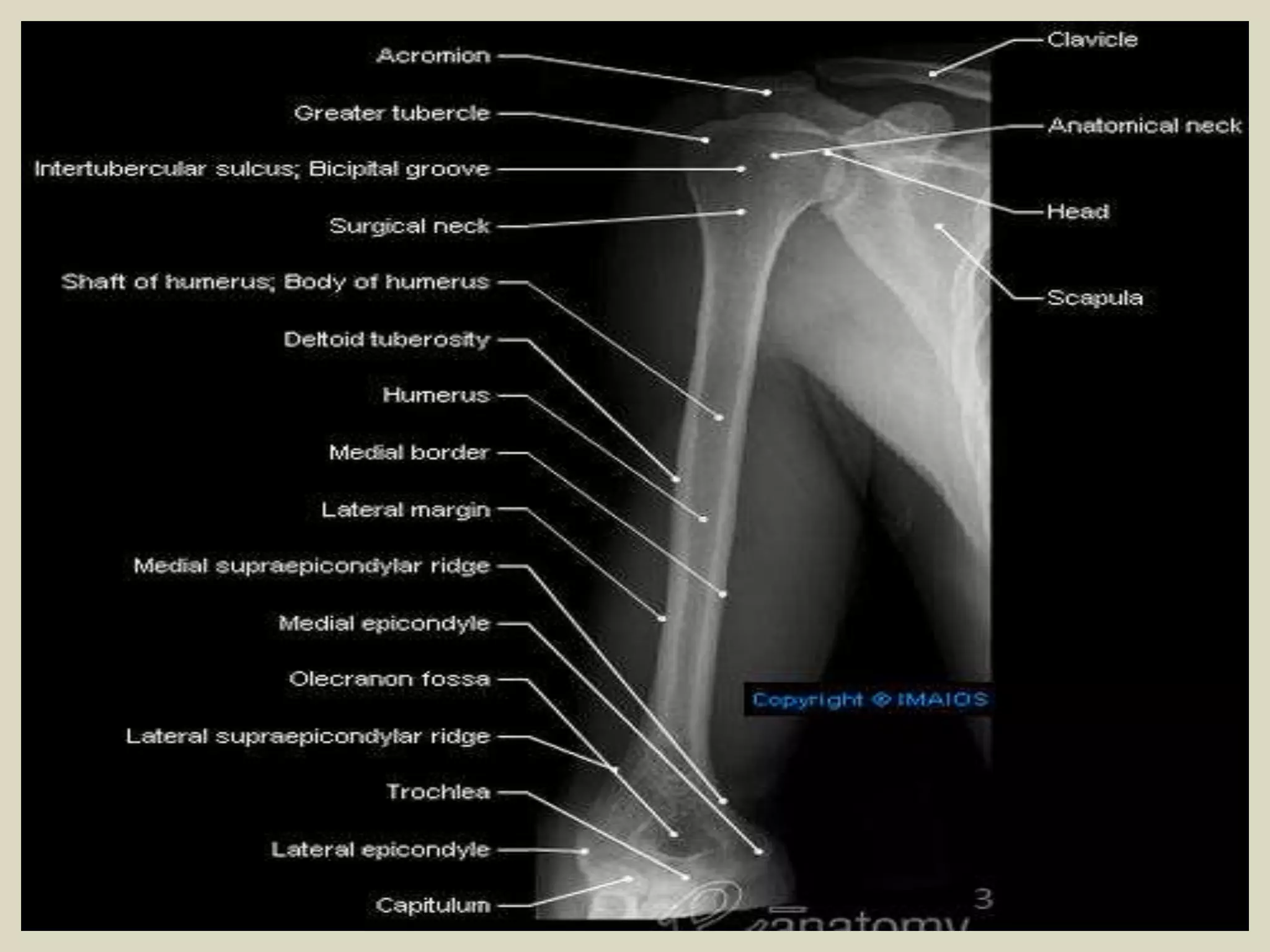 Presentation1.pptx, radiological anatomy of the arm and forearm. | PPTX
