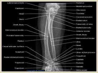 Presentation1.pptx, radiological anatomy of the arm and forearm. | PPT
