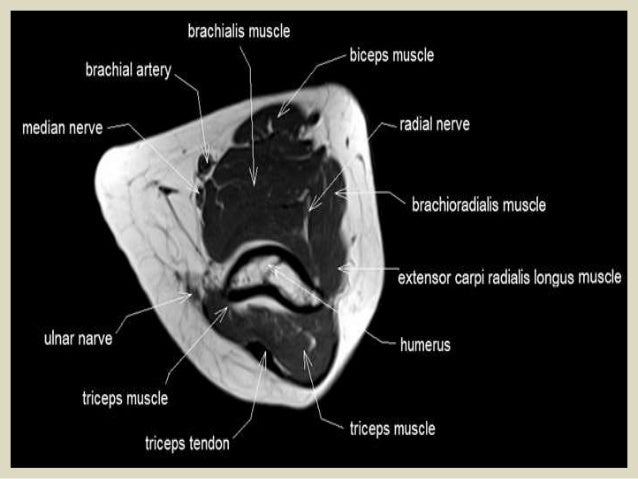Presentation1.pptx, radiological anatomy of the arm and forearm.