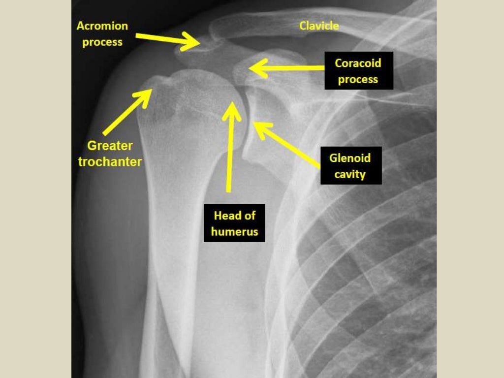 Presentation1.pptx, radiological anatomy of the arm and forearm.