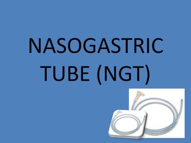 Presentation NGT | PPTX