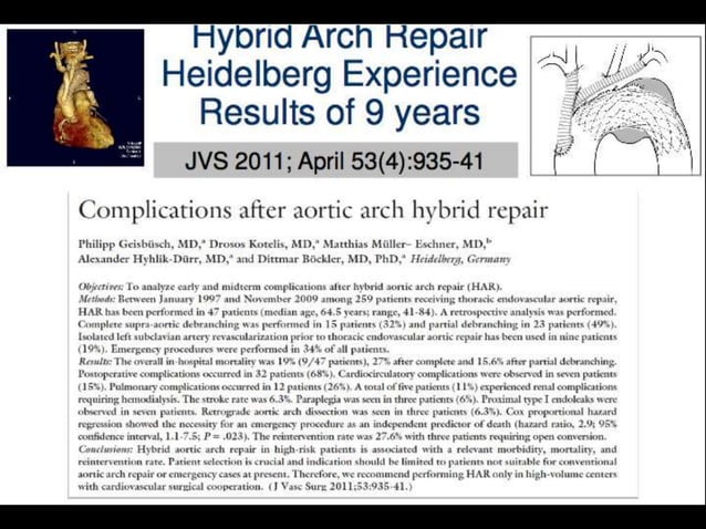Complex Aortic Arch Surgery | PPTX | Heart and Cardiovascular Diseases ...