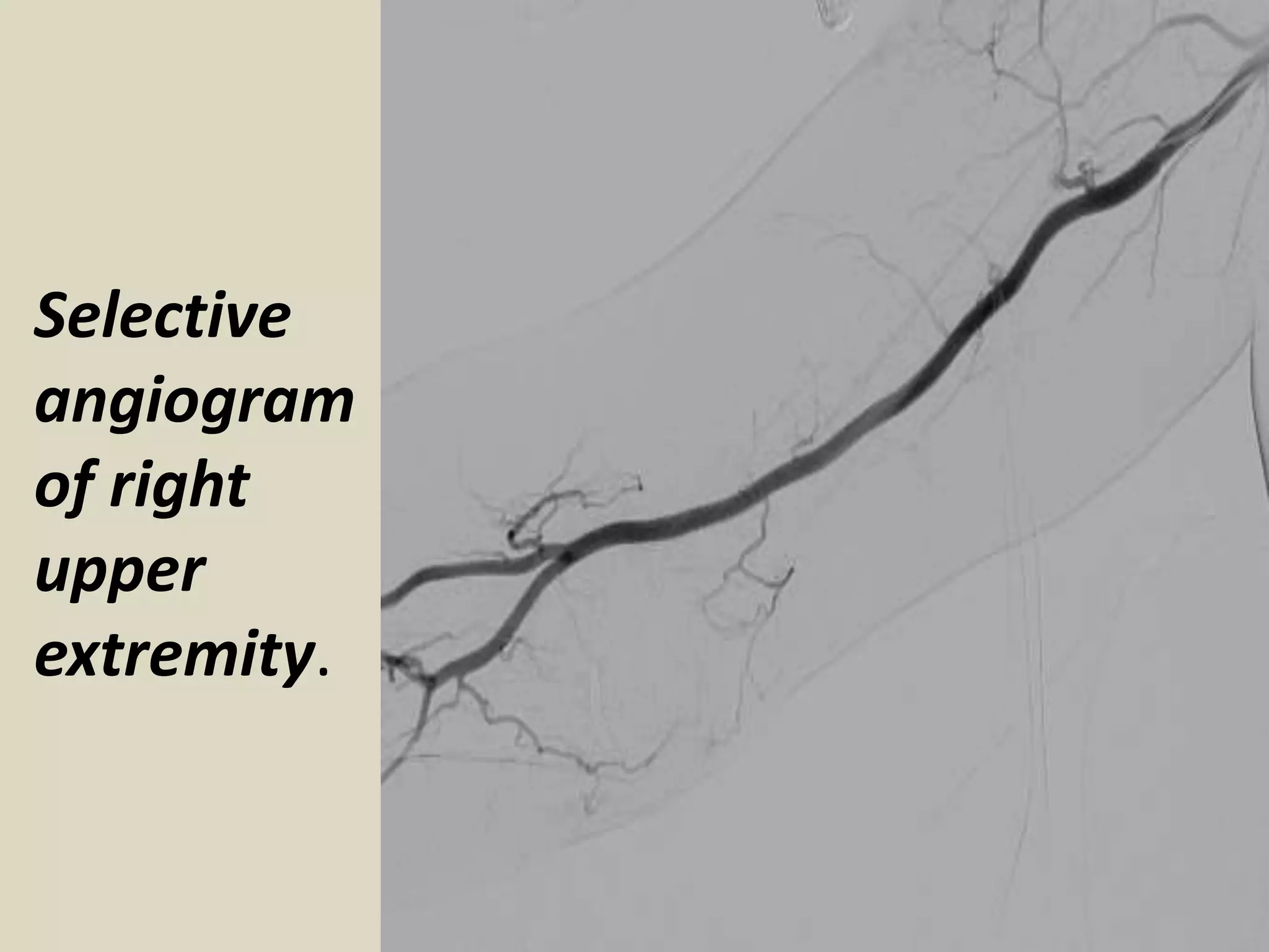 Presentation1.pptx, radiological vascular anatomy of the upper and ...