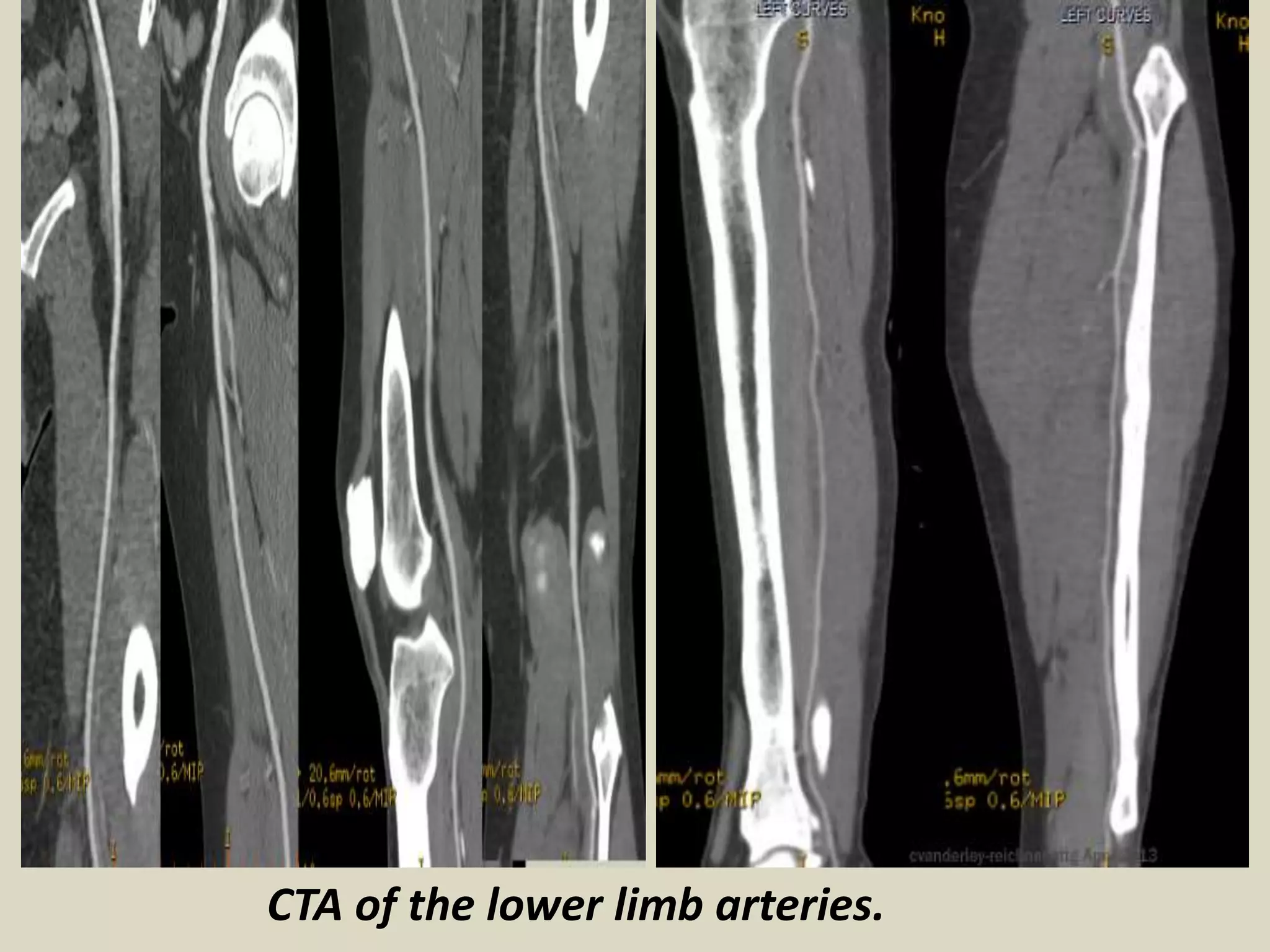 Presentation1.pptx, radiological vascular anatomy of the upper and ...