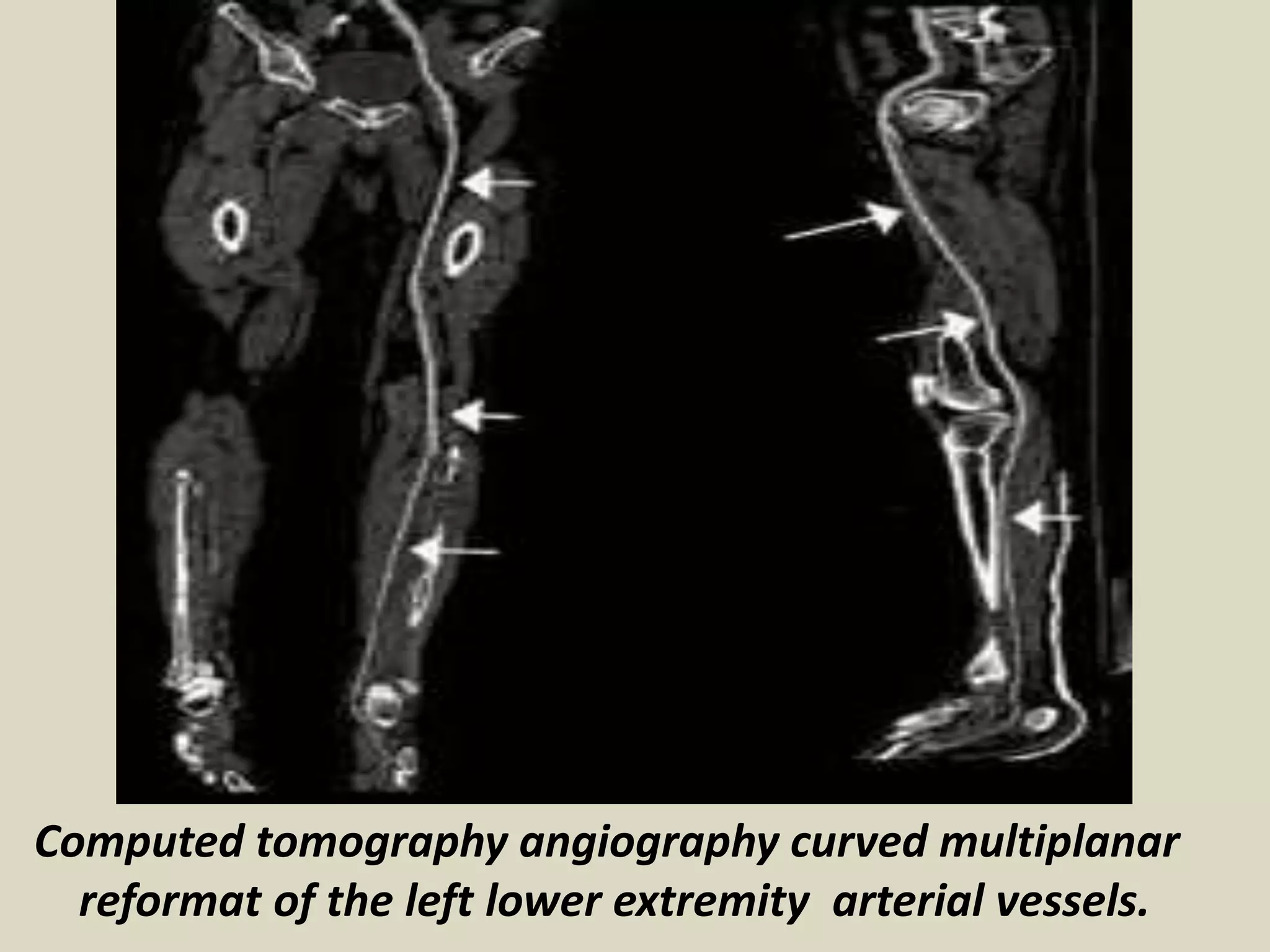 Presentation1.pptx, radiological vascular anatomy of the upper and ...