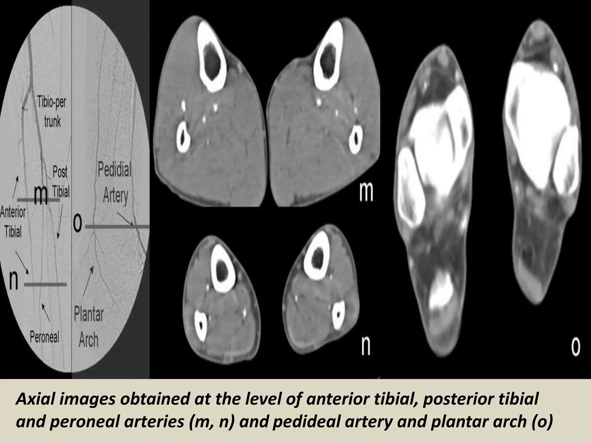 Presentation1.pptx, radiological vascular anatomy of the upper and ...