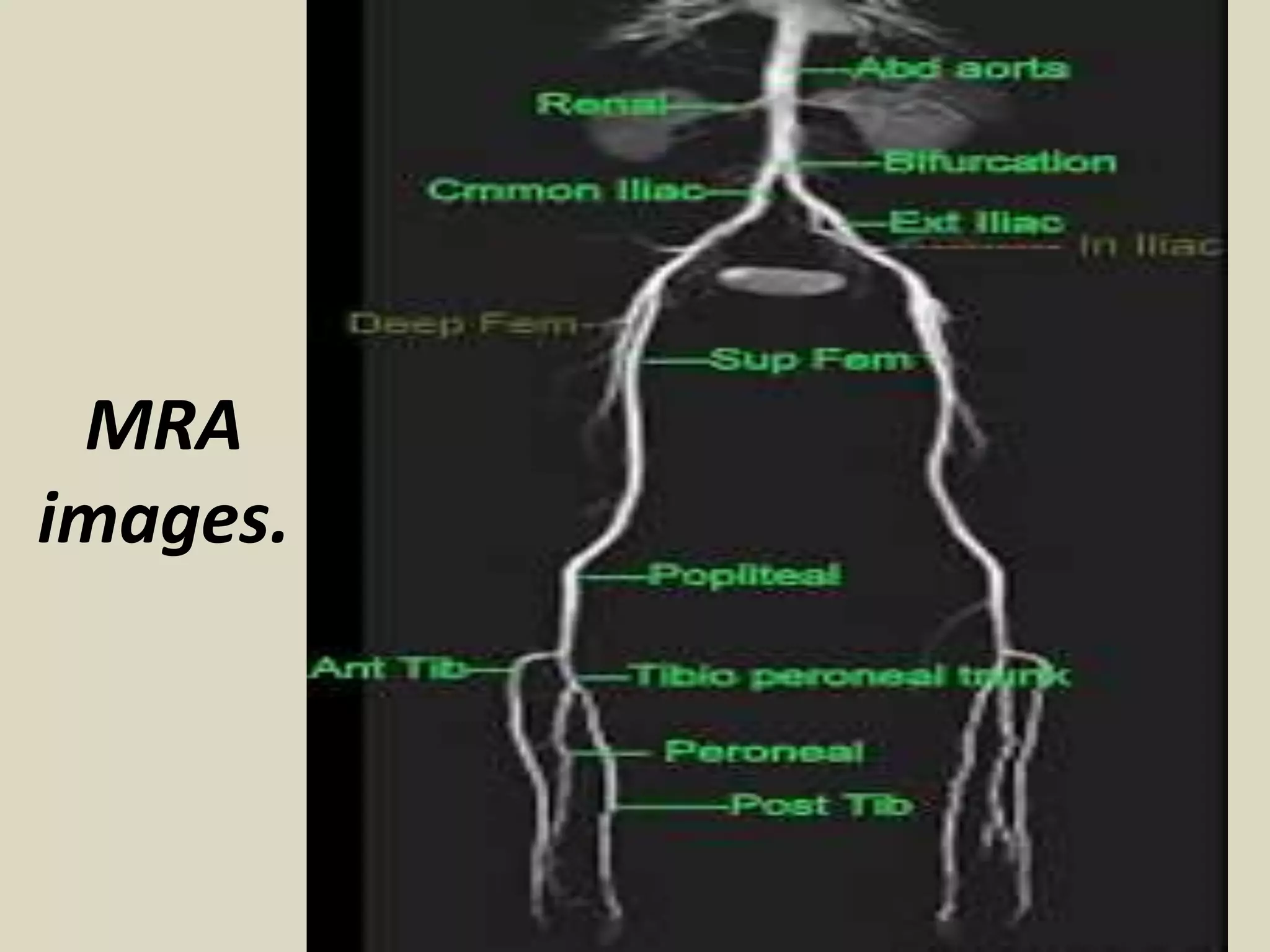 Presentation1.pptx, radiological vascular anatomy of the upper and ...
