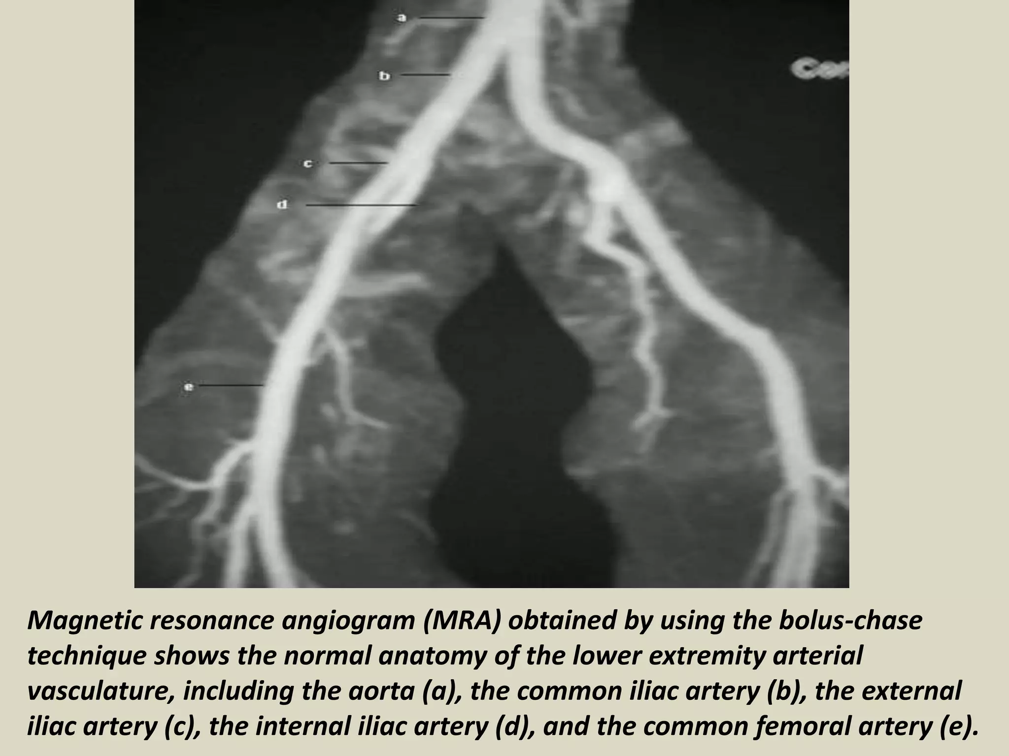 Presentation1.pptx, radiological vascular anatomy of the upper and ...