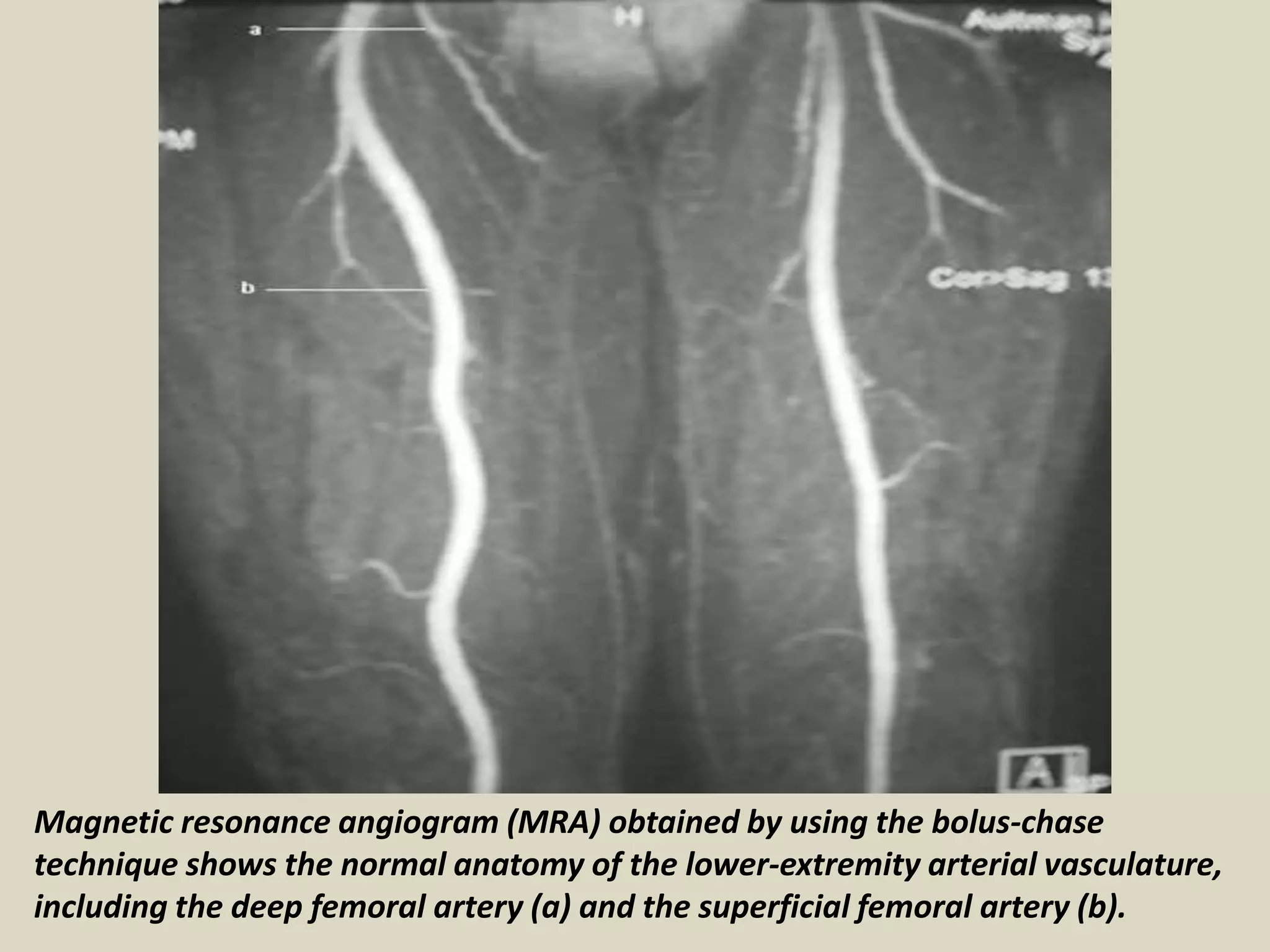 Presentation1.pptx, radiological vascular anatomy of the upper and ...