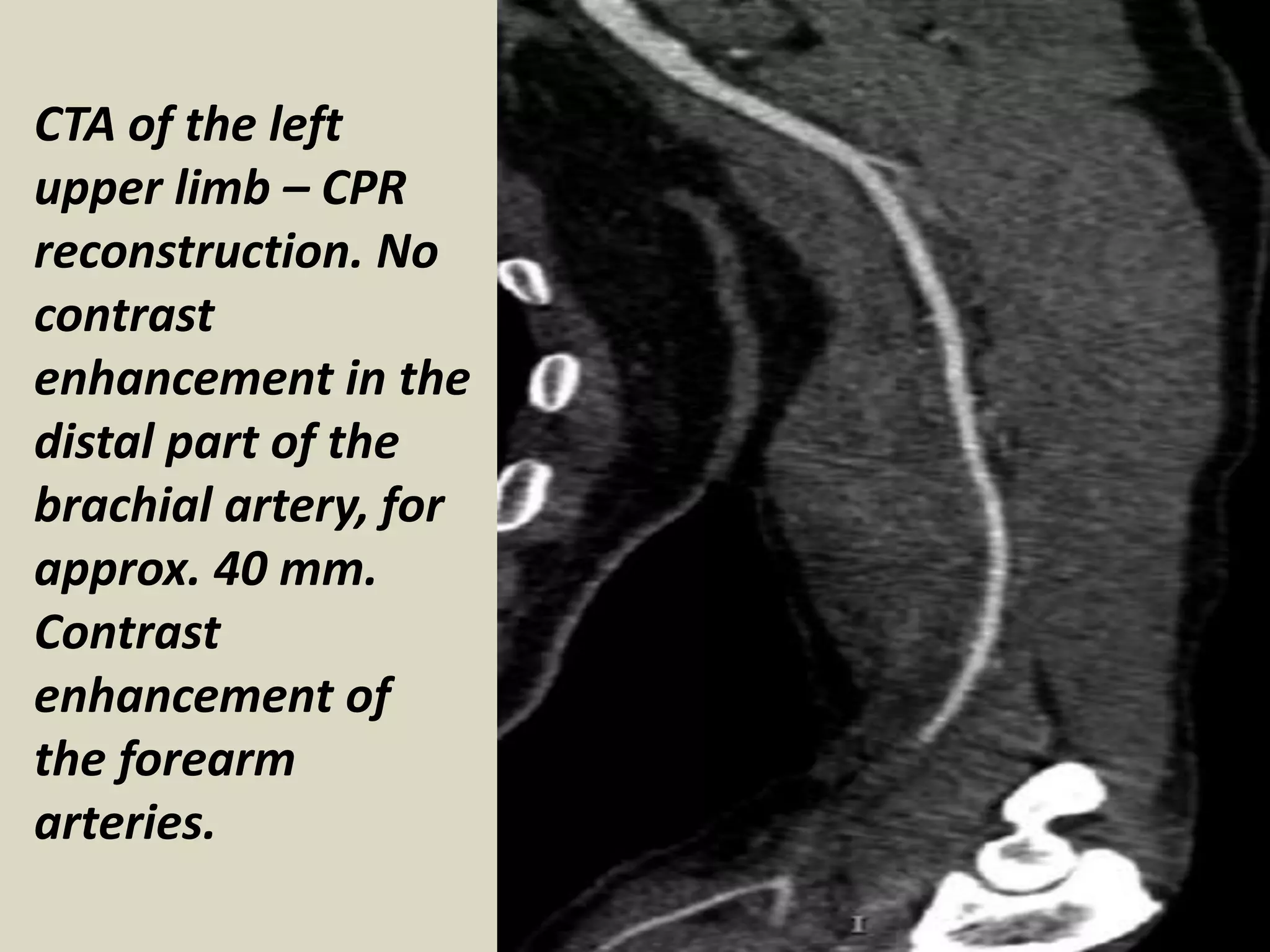 Presentation1.pptx, radiological vascular anatomy of the upper and ...
