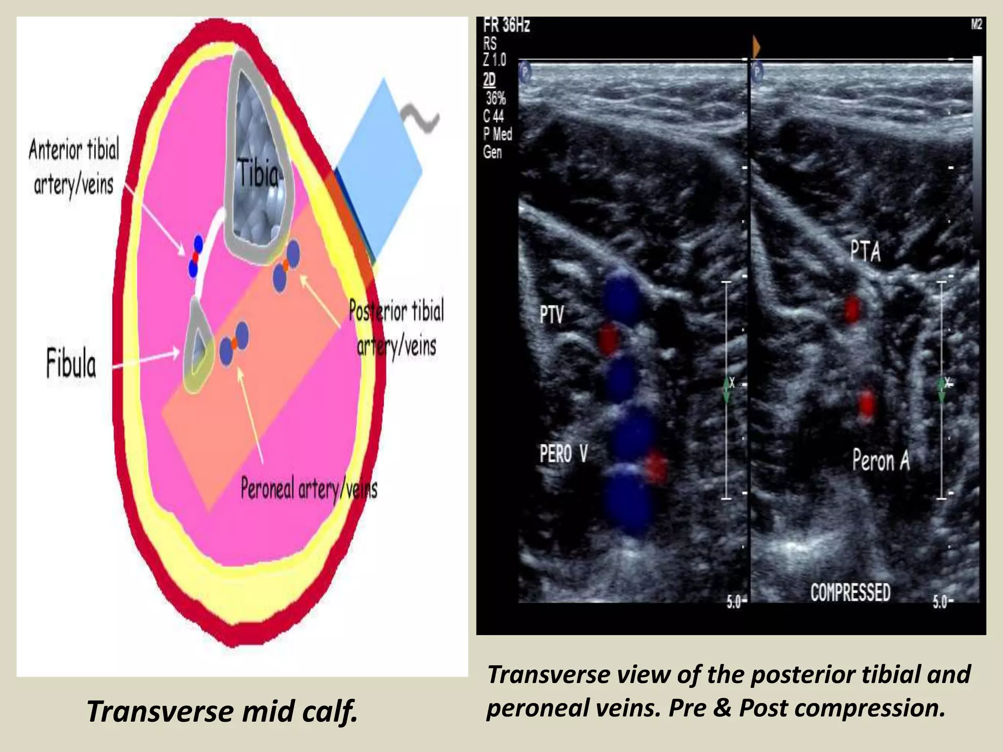 Presentation1.pptx, radiological vascular anatomy of the upper and ...
