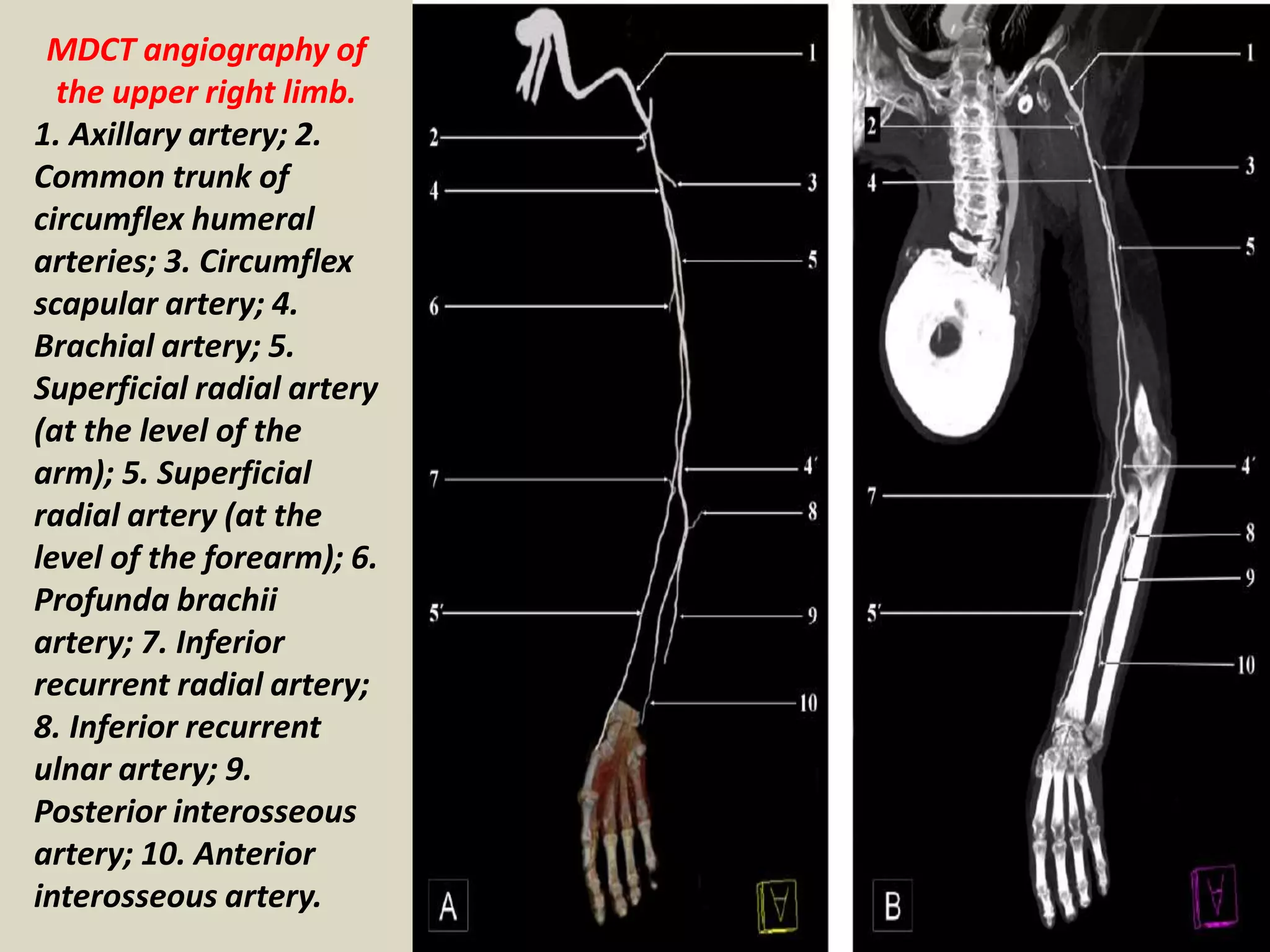 Presentation1.pptx, radiological vascular anatomy of the upper and ...