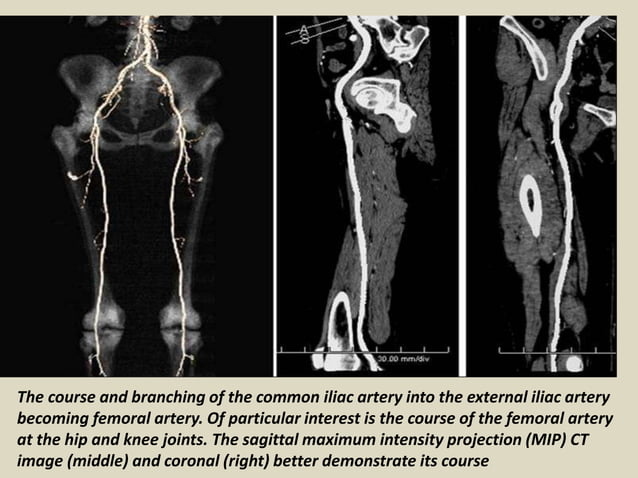 Presentation1.pptx, radiological vascular anatomy of the upper and ...
