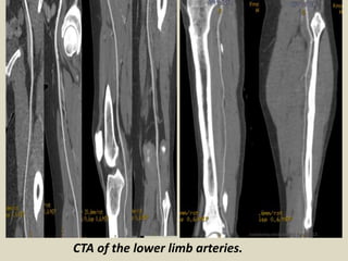 Presentation1.pptx, radiological vascular anatomy of the upper and ...