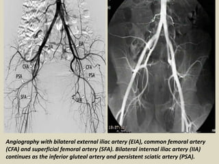 Presentation1.pptx, radiological vascular anatomy of the upper and ...