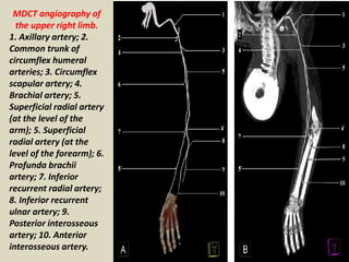 Presentation1.pptx, radiological vascular anatomy of the upper and ...