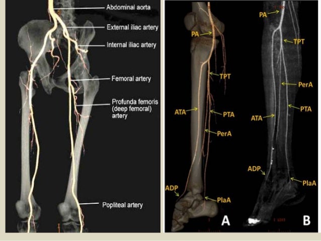 Vascular Anatomy Lower Extremity Anatomical Charts Posters Vascular Anatomy Lower Extremity Anatomical Charts Posters