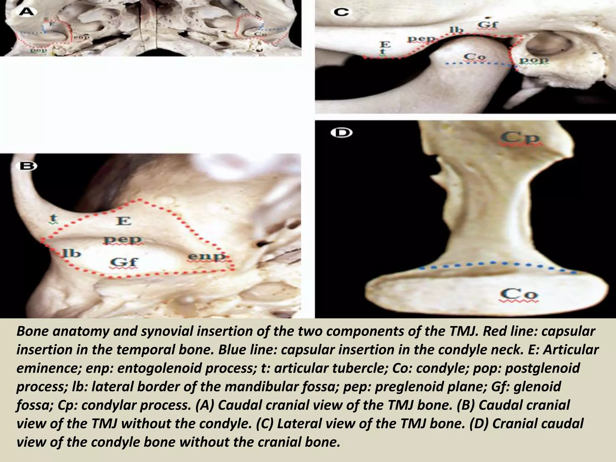 Presentation1.pptx, radiological anatomy of the temporo mandibular ...