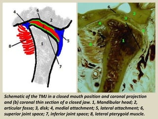 Presentation1.pptx, radiological anatomy of the temporo mandibular ...