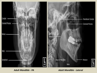 Temporomandibular Joint X Ray