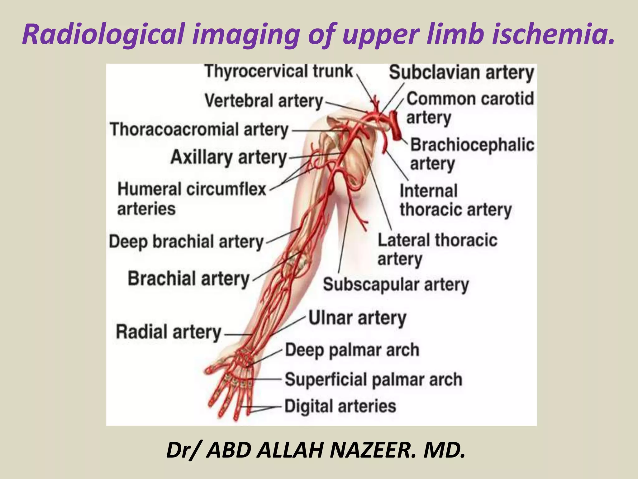 Presentation1.pptx, radiological imaging of upper limb ischemia. | PPTX