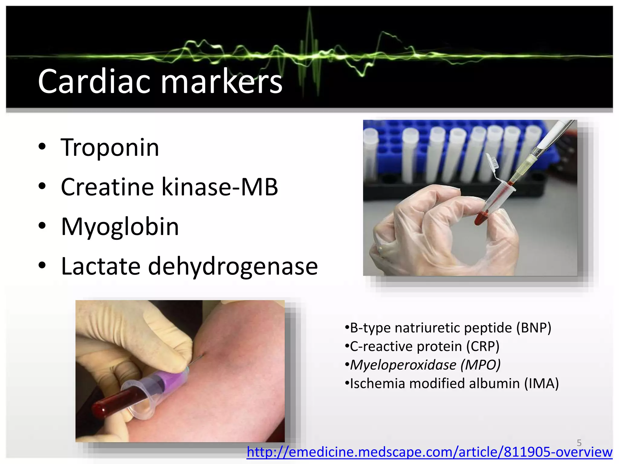 Cardiac Markers | PPTX