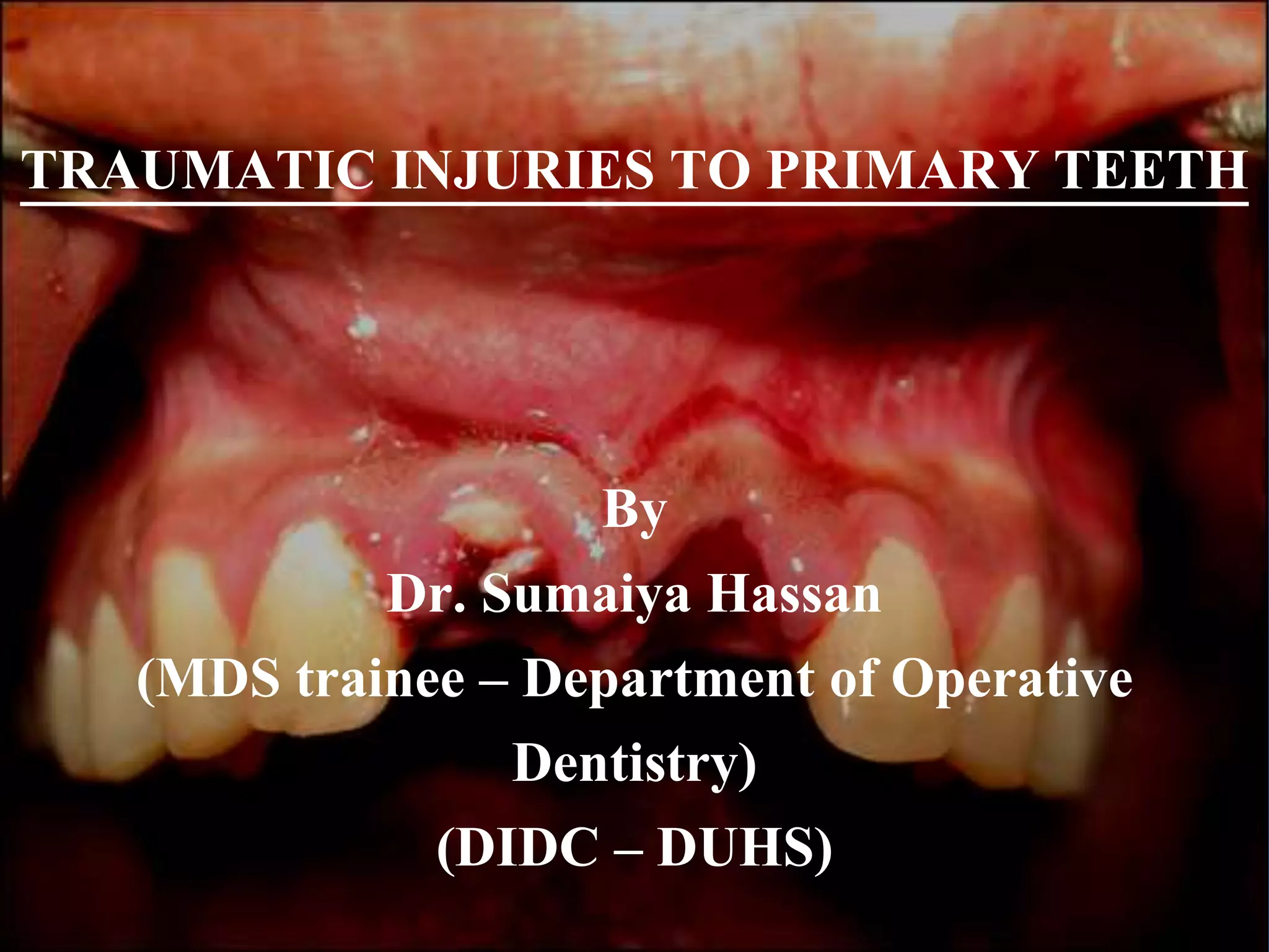 Trauma To Primary Teeth | PPTX