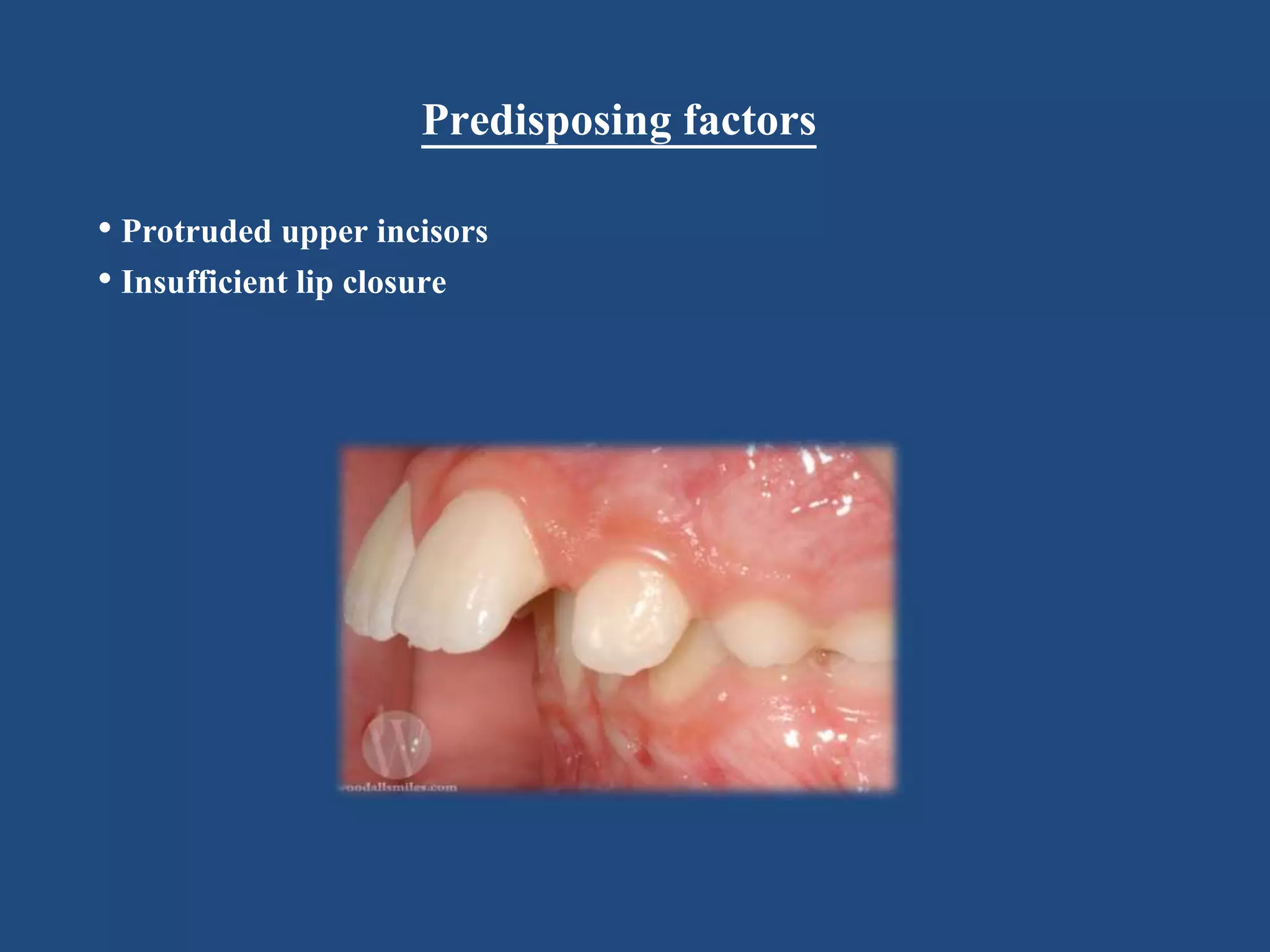 Trauma To Primary Teeth | PPTX