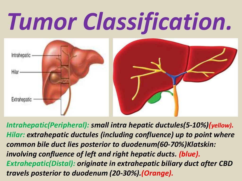 Presentation1.pptx, radiological imaging of cholangiocarcinoma.