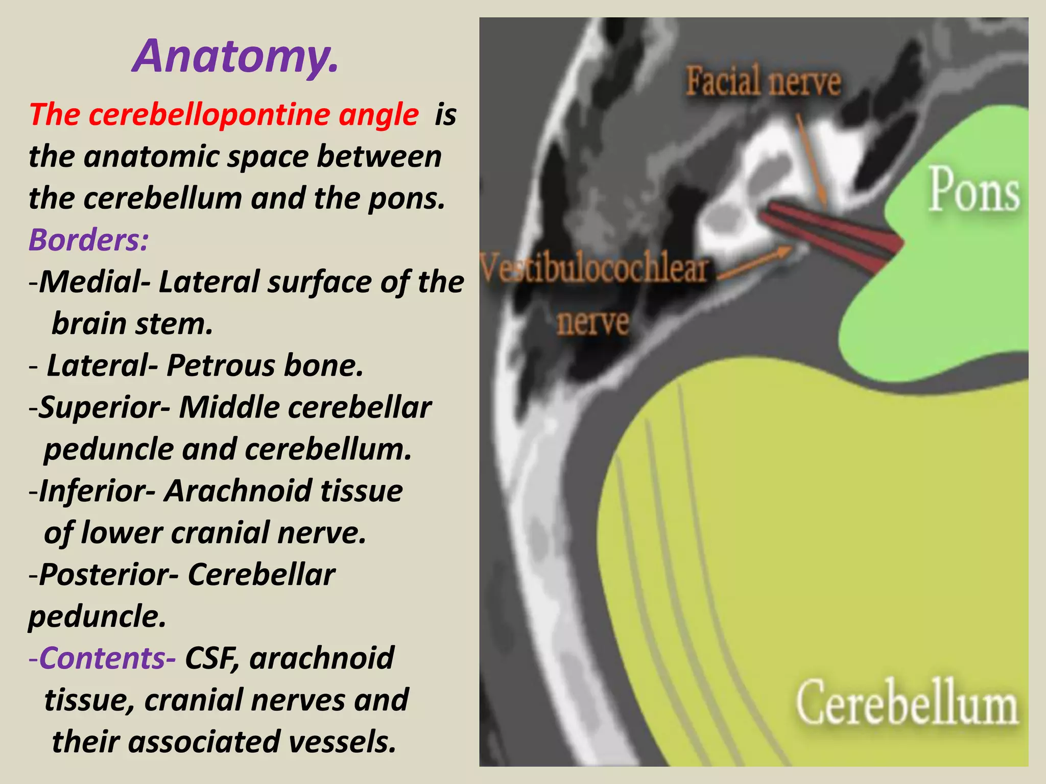 Presentation1.pptx, radiological imaging of cerebello pontine angle mass lesions. | PPTX