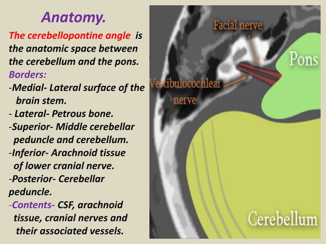 Presentation1.pptx, radiological imaging of cerebello pontine angle ...
