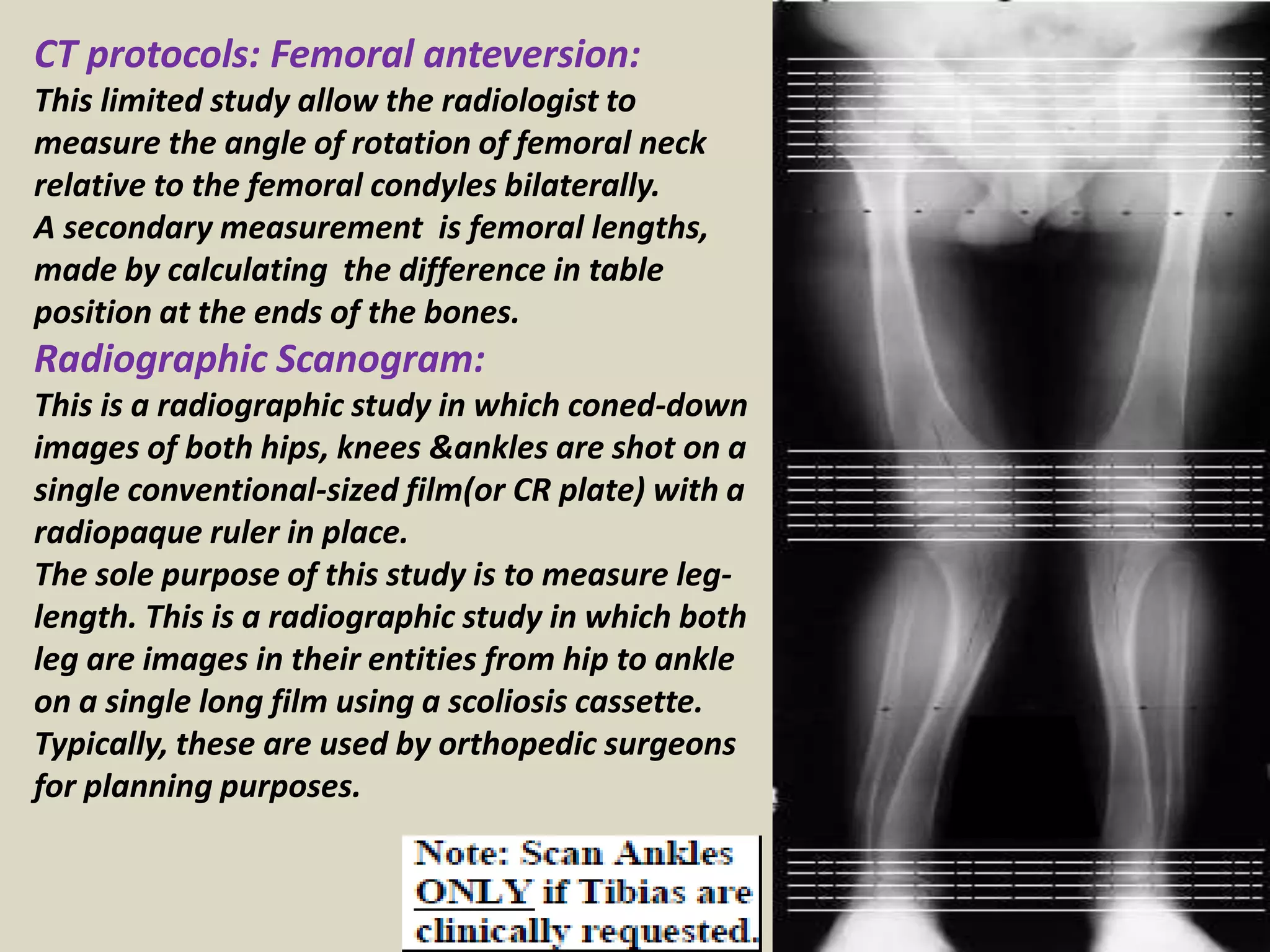 Presentation1.pptx, radiological imaging of anteversion angle. | PPTX