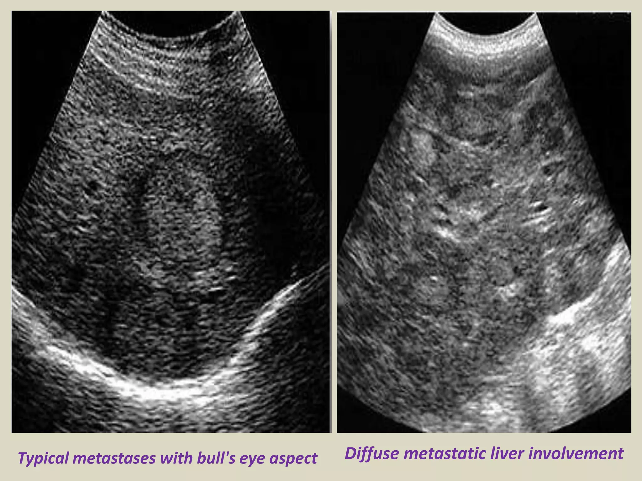 Presentation1.pptx, ultrasound examination of the liver and gall ...
