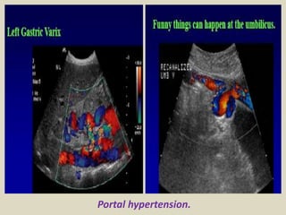 Normal Vs Abnormal Liver Ultrasound