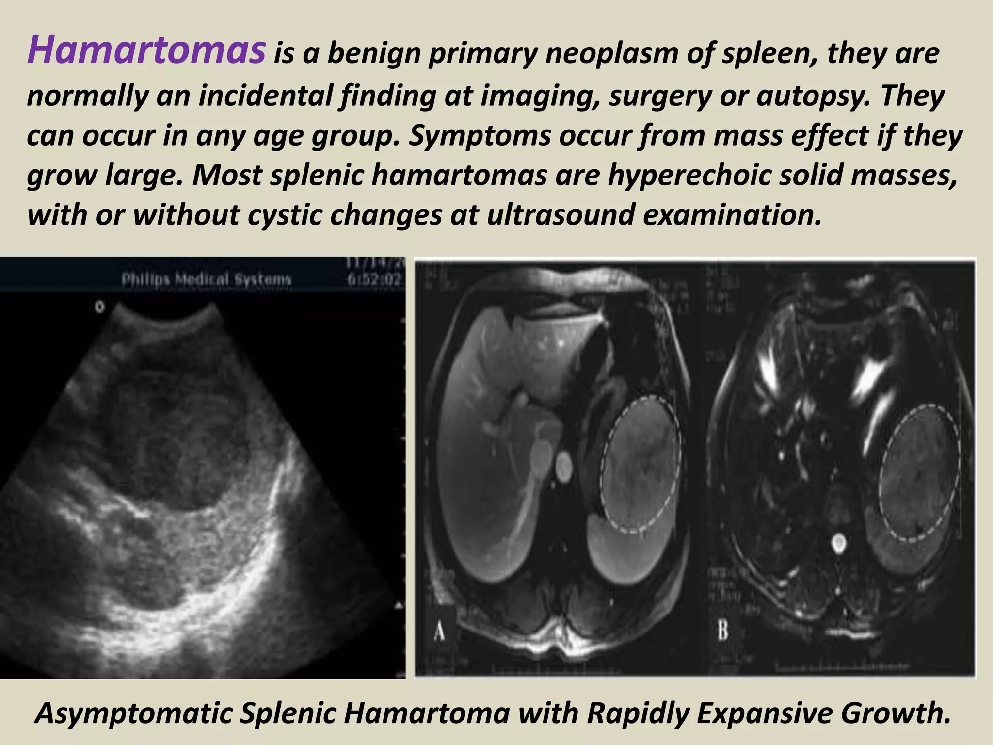 Presentation1.pptx, ultrasound study of the spleen and pancreas. | PPTX