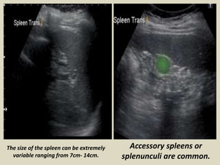 Normal Spleen Ultrasound