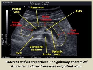 Presentation1.pptx, ultrasound study of the spleen and pancreas. | PPT