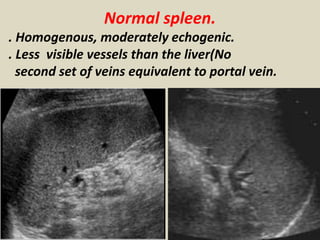 Normal Spleen Ultrasound