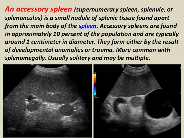 Presentation1.pptx, ultrasound study of the spleen and pancreas.
