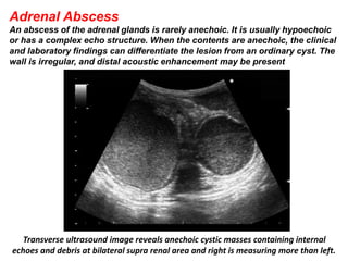 Presentation1.pptx, ultrasound examination of the adrenal glands and ...