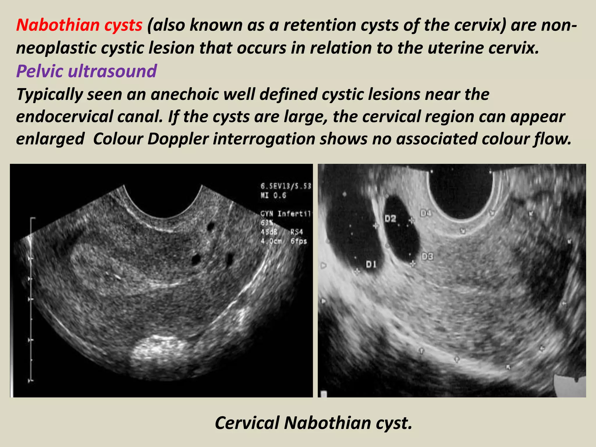 Presentation1.pptx, ultrasound examination of the uterus and ovaries ...