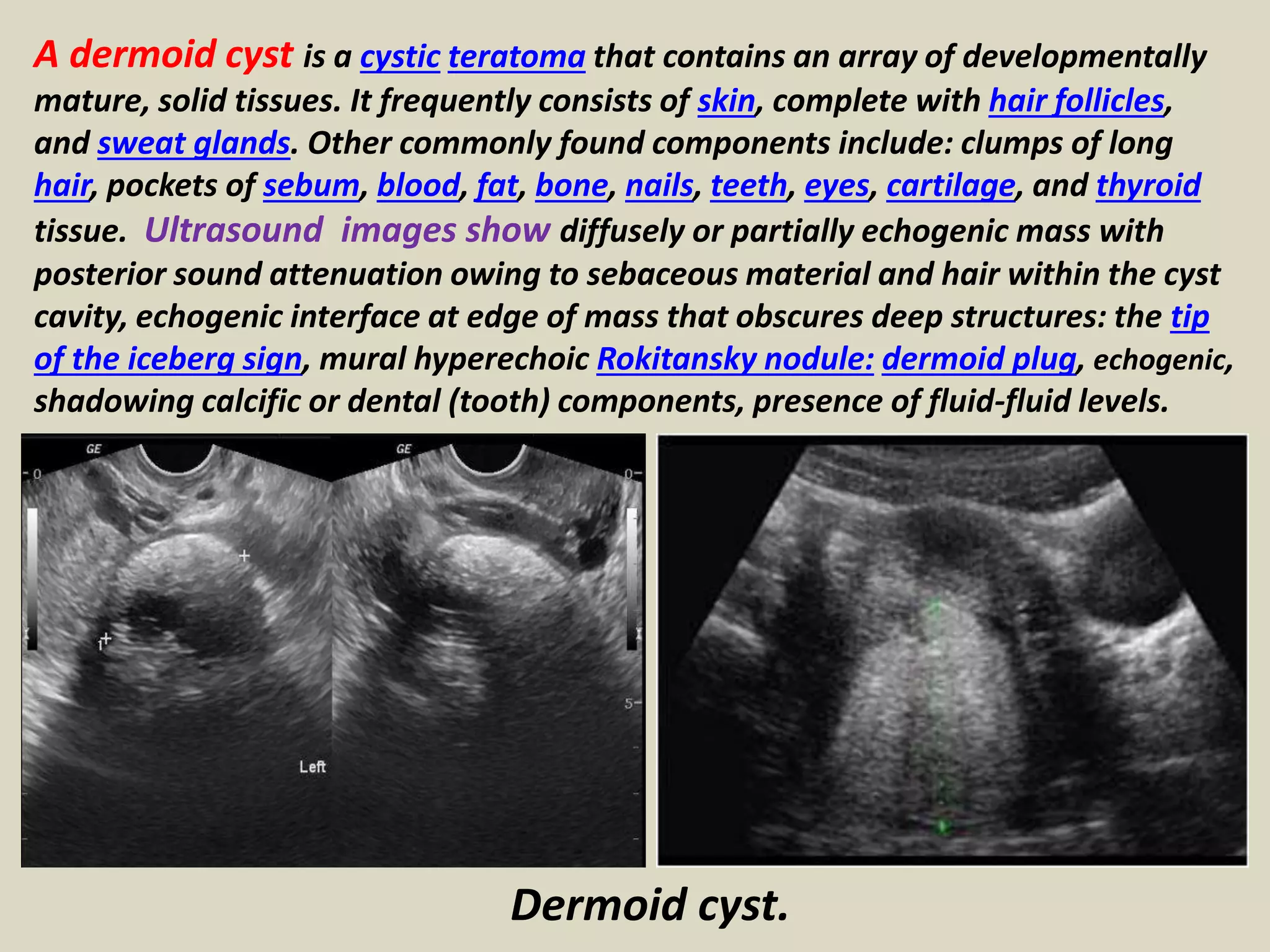 Presentation1.pptx, ultrasound examination of the uterus and ovaries ...